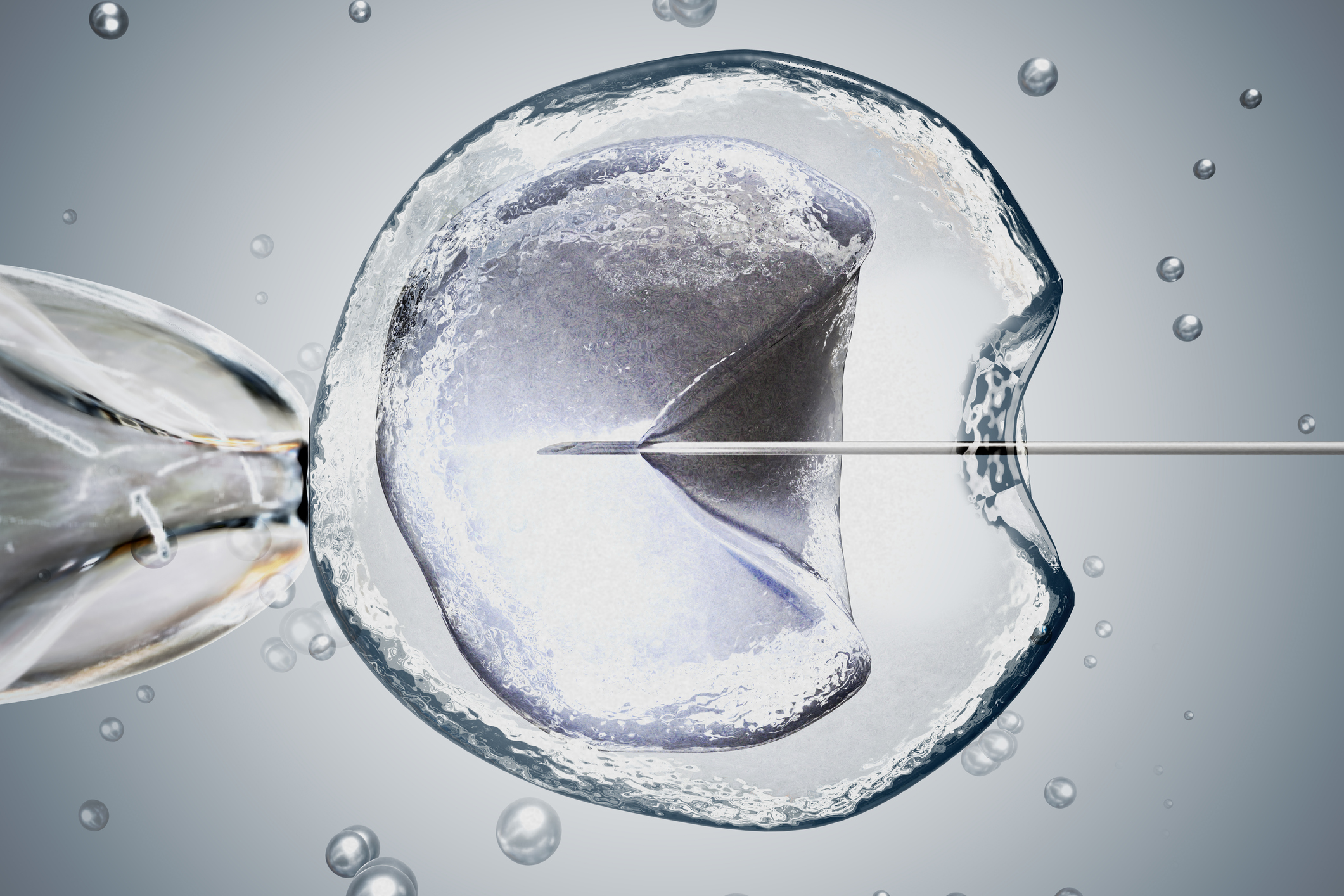 La procedura di freeze all - Progetto Iside - fecondazione assistita